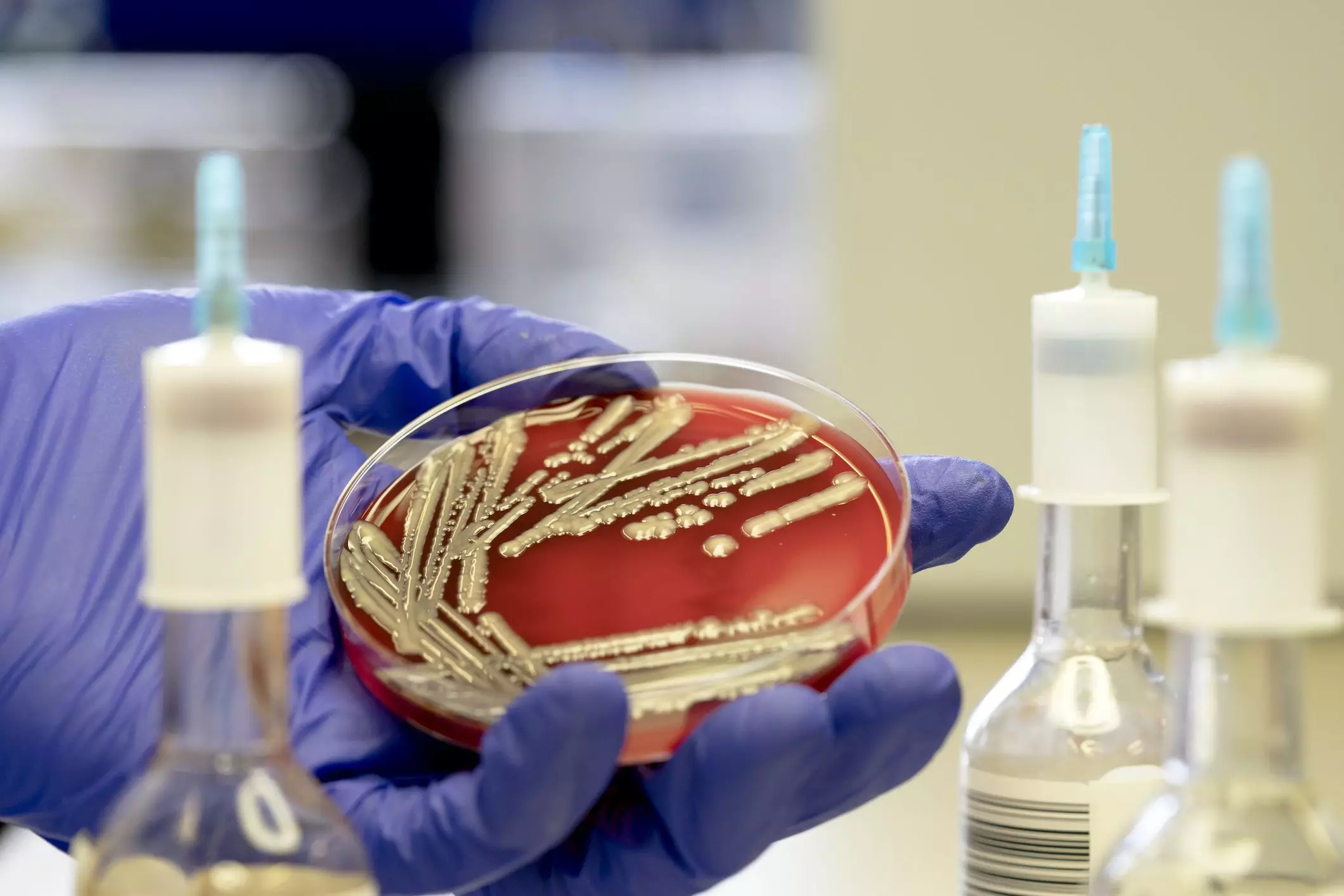 Az E. coli-t a génklónozáshoz használt okok
