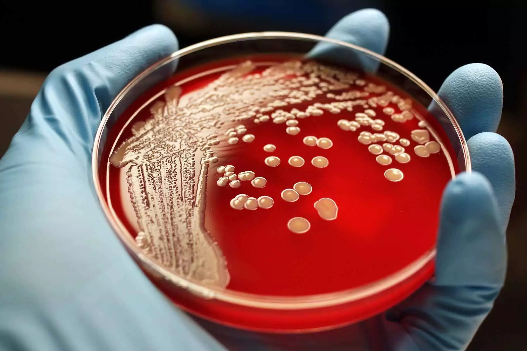 MRSA-bakterier som växer i en petriskål.