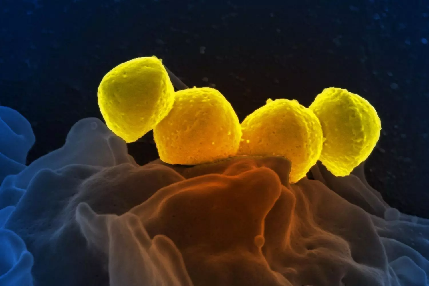 Mikrograf elektron pemindaian Streptococcus Grup A (Streptococcus pyogenes), bakteri yang menyebabkan radang tenggorokan, impetigo, dan necrotizing fasciitis (penyakit pemakan daging).