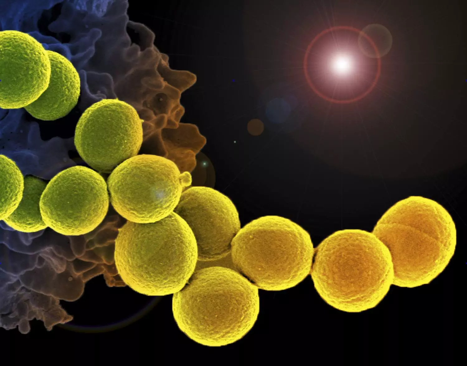 تُعرف البكتيريا الظاهرة هنا باللون الأصفر باسم MRSA ، وهي سلالة مقاومة للمضادات الحيوية من بكتيريا Staphylococcus aureus.