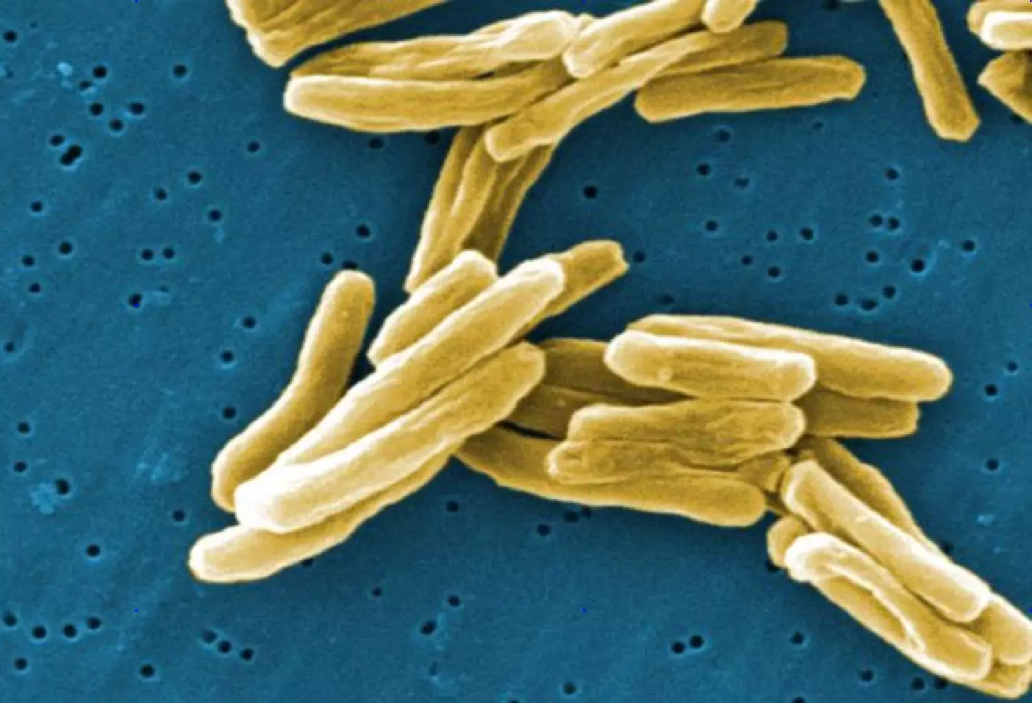 Diese rasterelektronenmikroskopische Aufnahme (SEM) zeigt eine Reihe von grampositiven Mycobacterium tuberculosis-Bakterien. TB-Bakterien werden aktiv und beginnen sich zu vermehren, wenn das Immunsystem sie nicht am Wachstum hindern kann. Die Bakterien greifen den Körper an und zerstören Gewebe. In der Lunge können die Bakterien tatsächlich ein Loch im Lungengewebe erzeugen.
