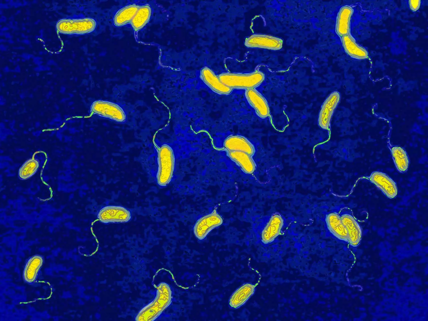 Ini adalah basil kolera atau vibrion (Vibrio cholerae).