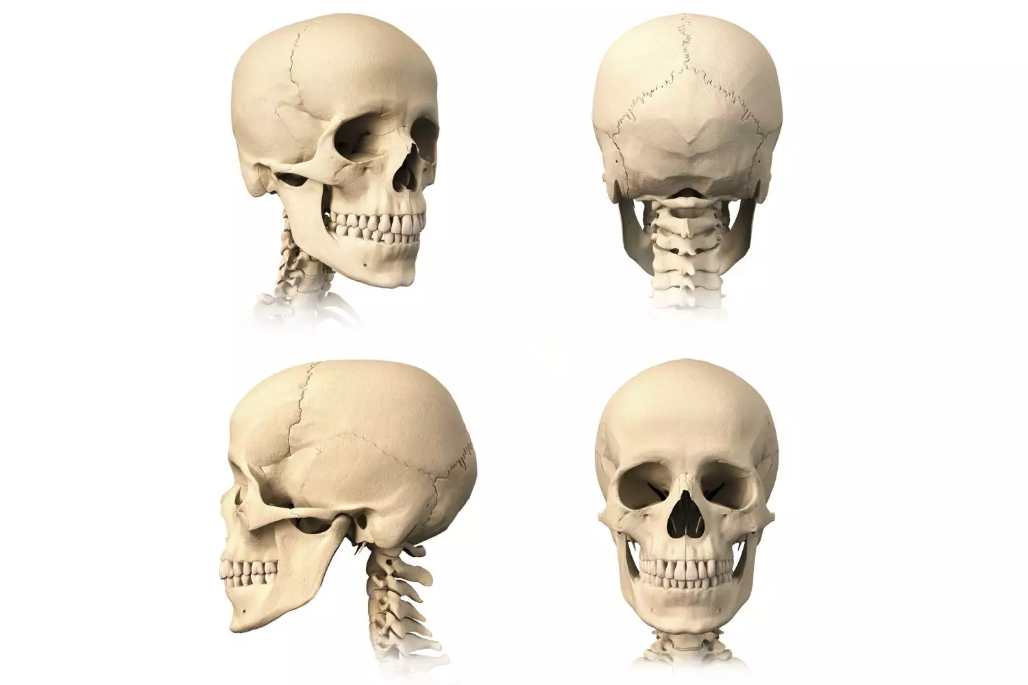 白い背景に骨が見える複数の角度から頭蓋骨を示す図。