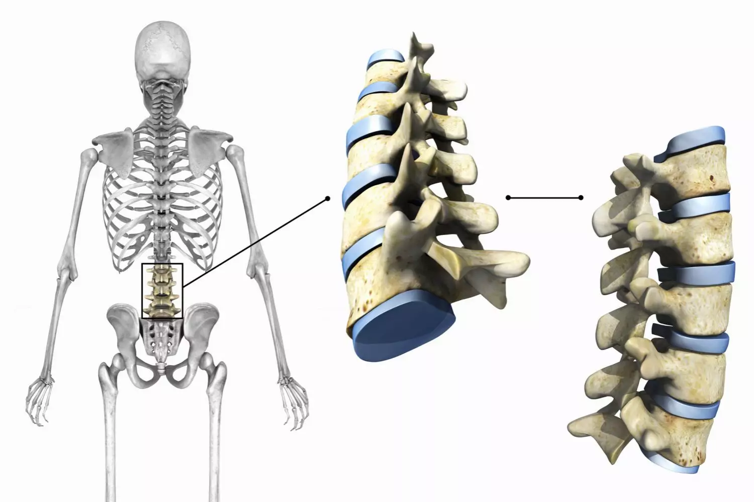 Dhiagiramu inoratidza lumbar vertebrae uye majoini pane chena kumashure.