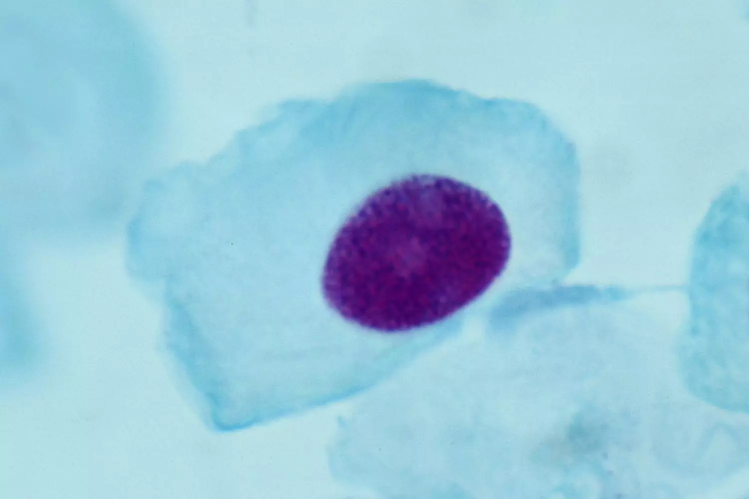 Meiosis ၏အဆင့်များခြုံငုံသုံးသပ်ချက်