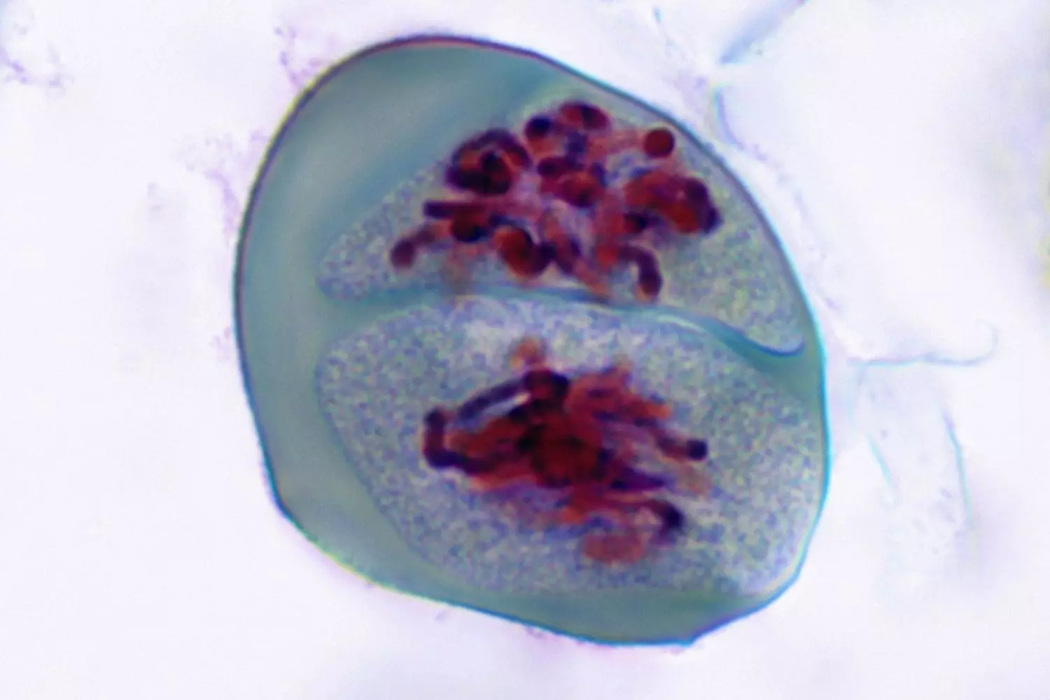Meiosis Prophase II