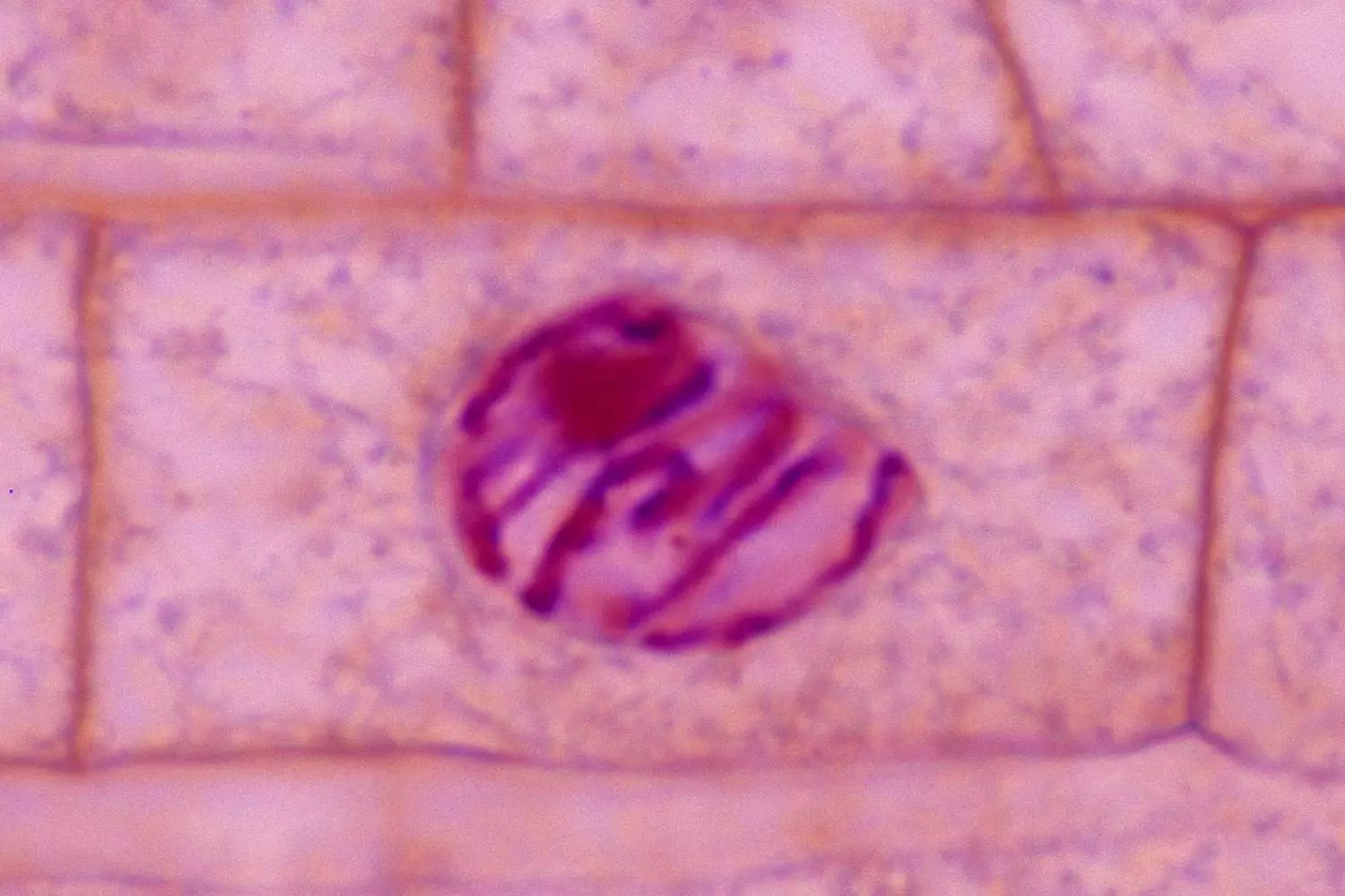 Prophase