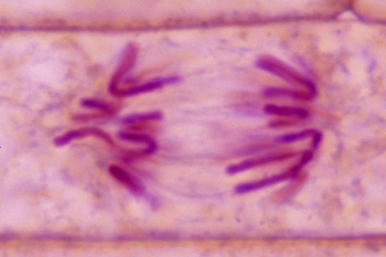 Anaphase