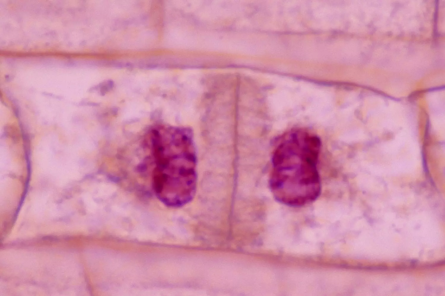 Telophase