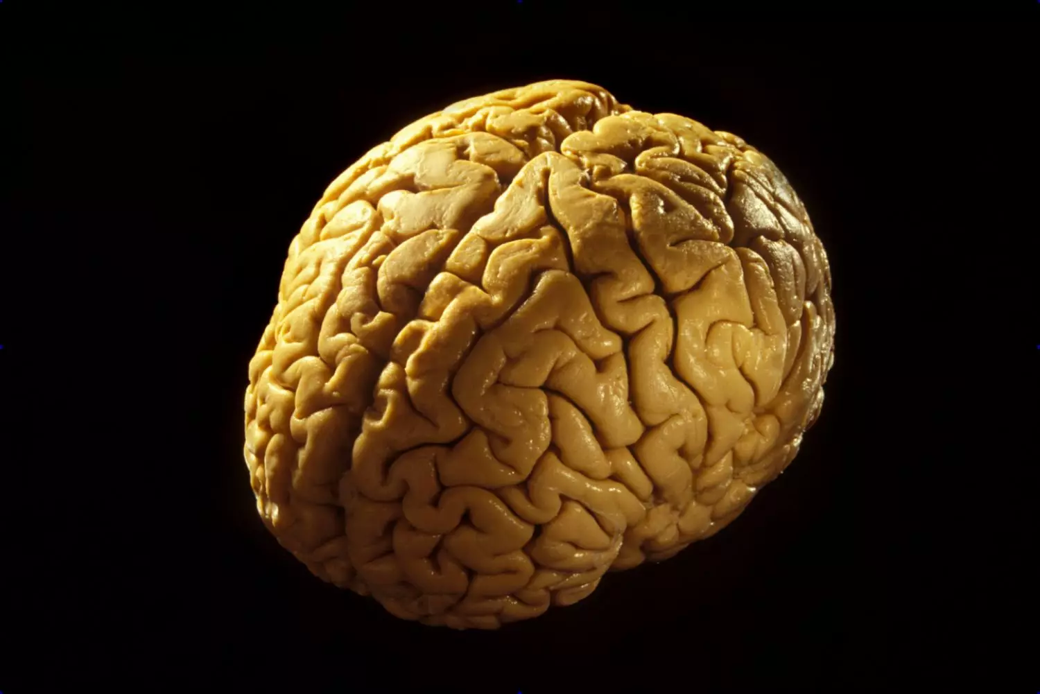 Anatomia mózgu: Cerebrum