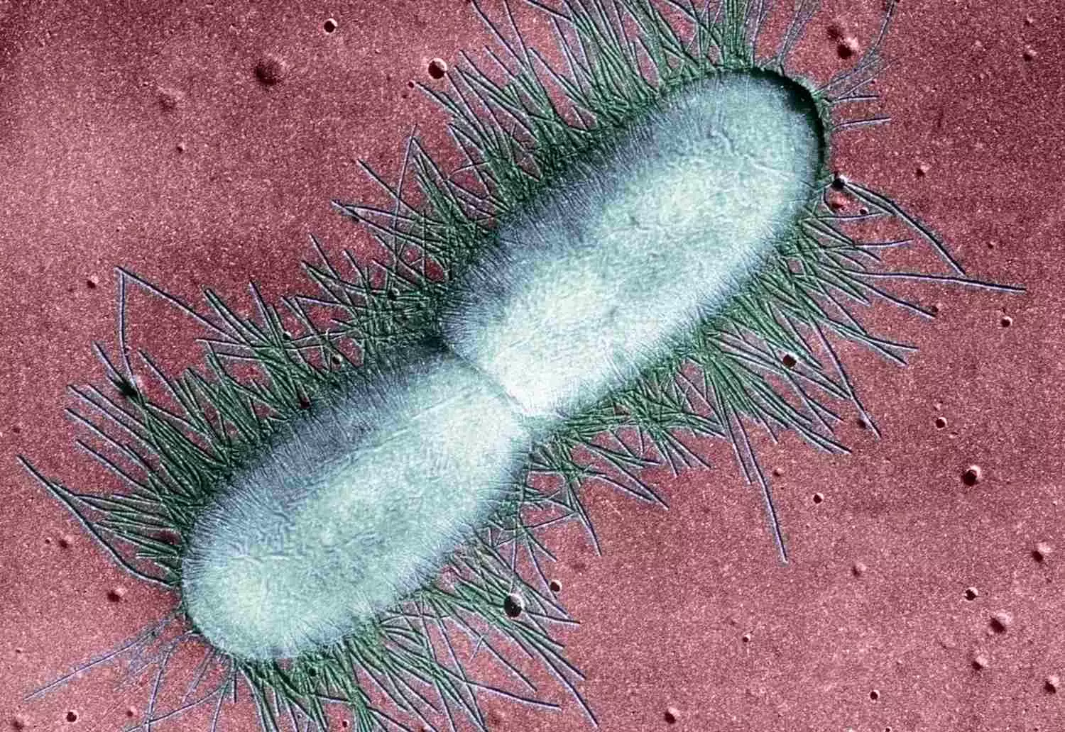 E. Coli bakteriyasi