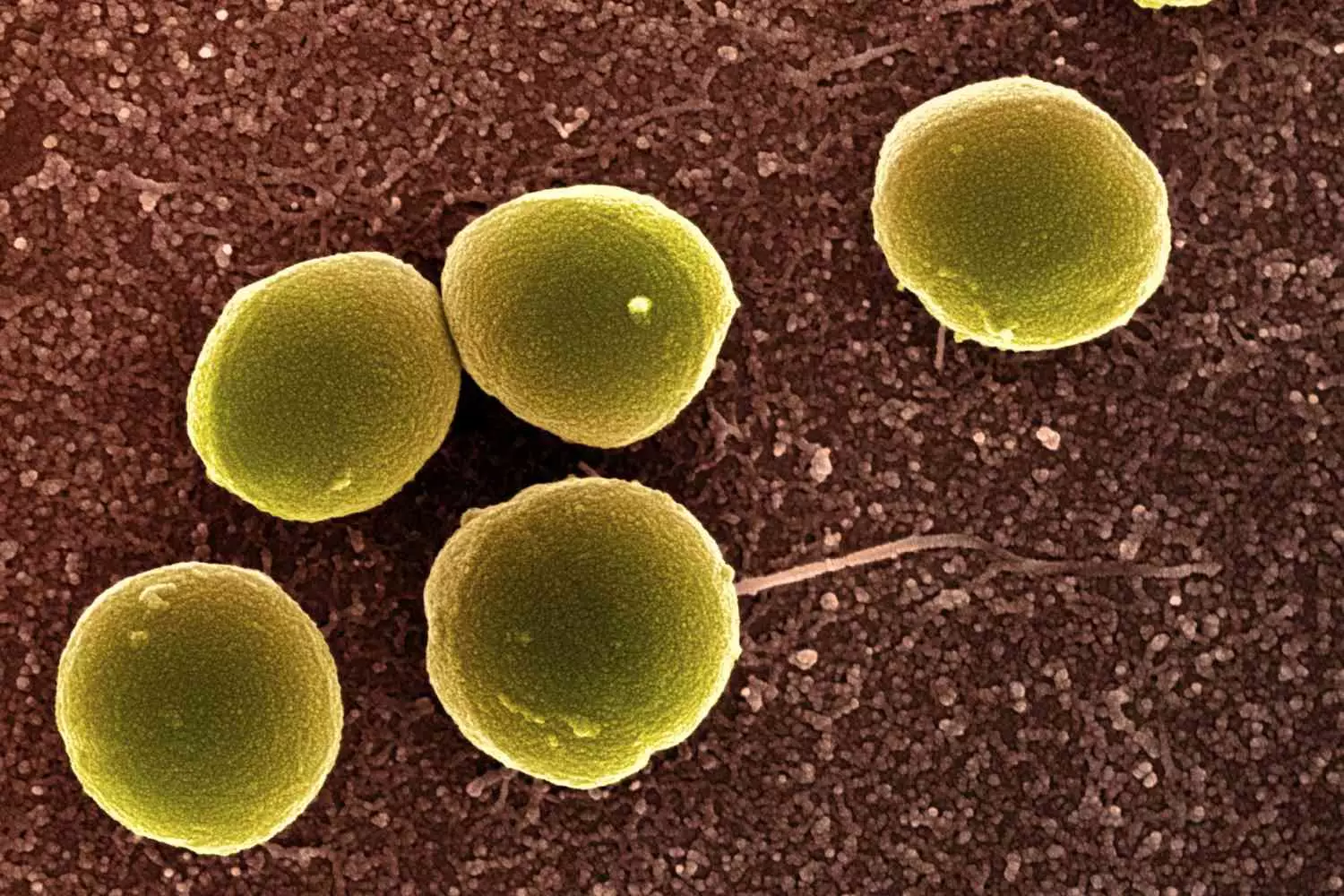 I-Staphylococcus aureus